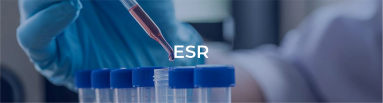 ERYTHROCYTE SEDIMENTATION RATE (ESR) | Saba Indomedika
